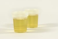 Shy Bladder DOT Test - InOut Labs